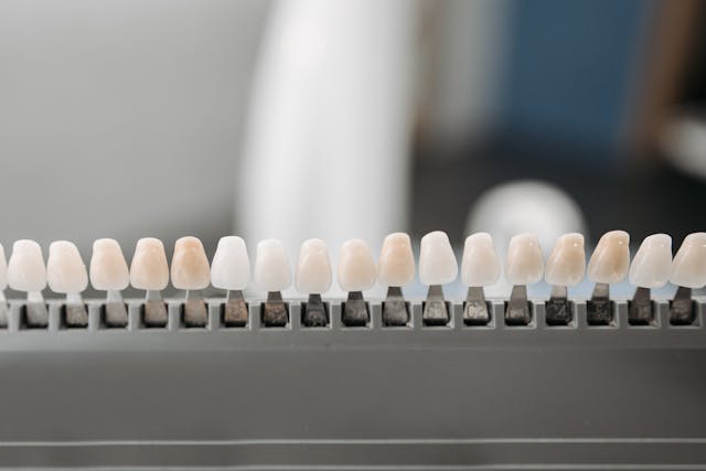 The Process of Getting Dental Veneers: A Step-by-Step Guide - ePub Zone